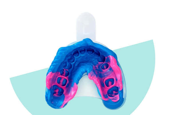 Impressions Dental Saving Time And Money With The Right Impression